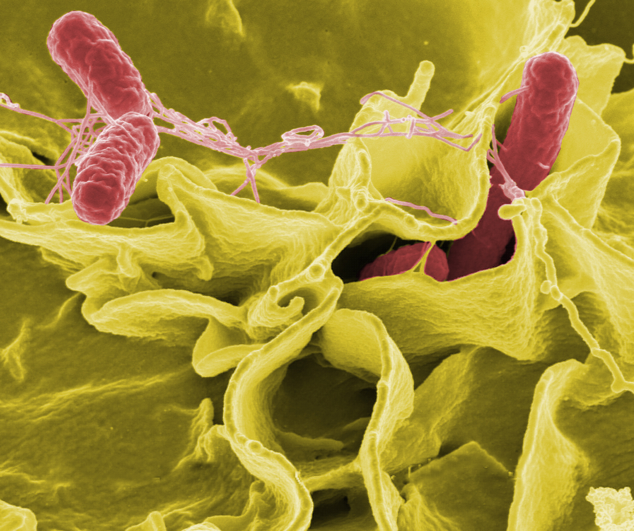 Salmonella për luftë kundër kancerit - Keshilla.NET