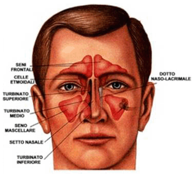 Infeksionet e sinuseve rezistente ndaj antibiotikëve - Keshilla.NET